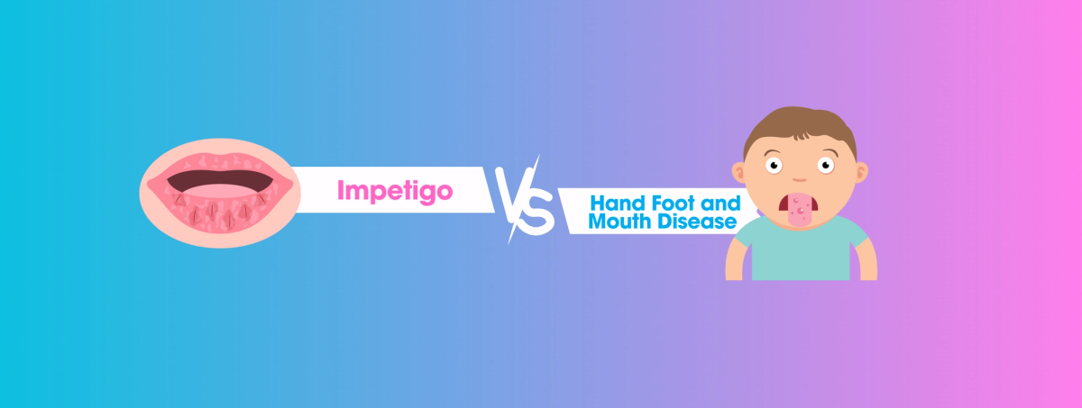 Impetigo vs. Hand Foot and Mouth Disease