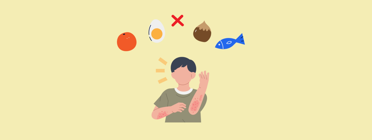 Understanding Food Allergy Symptoms: Tips for Testing and Management | Buoy