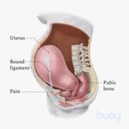Ligamento Redondo Gu a De Salud Vidaliax
