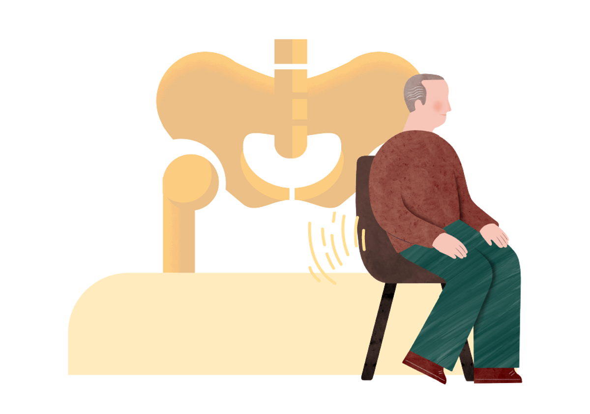 Snapping Hip Syndrome | Symptoms & How to Treat It