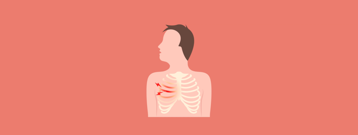 Top Treatments For Rib Fractures Buoy