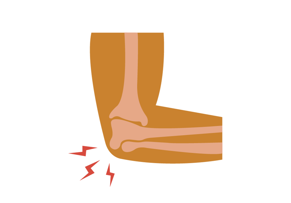 Severe Elbow Pain Symptoms, Causes & Common Questions | Buoy