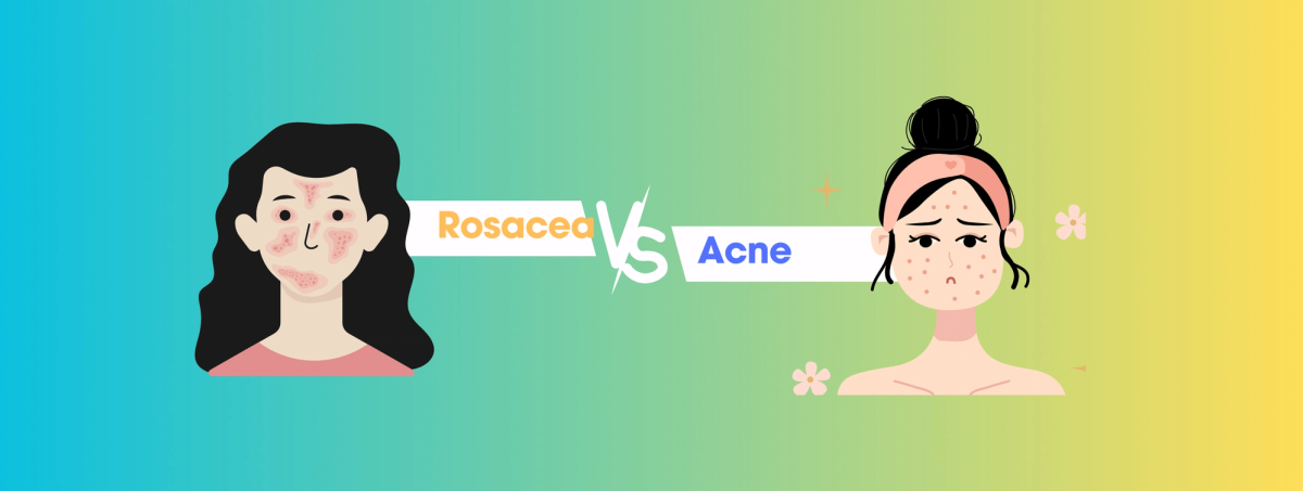 Rosacea vs Acne | Buoy