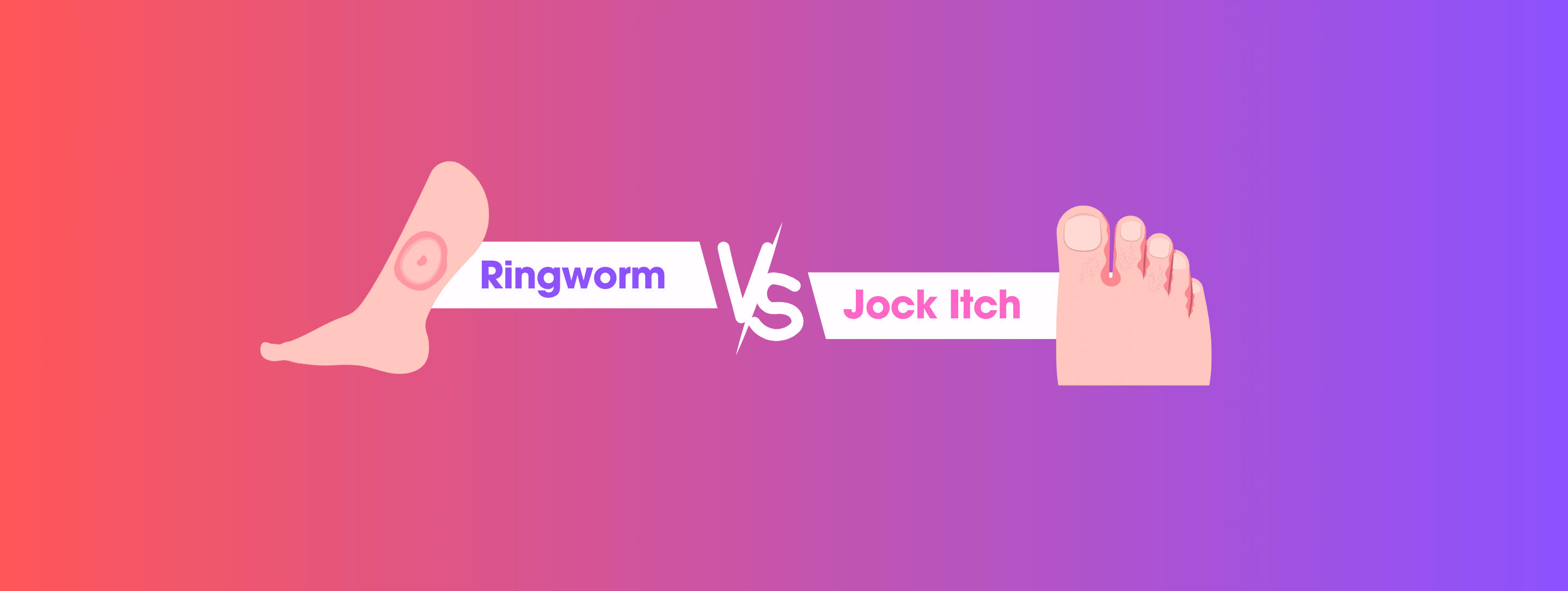 Ringworm vs. Jock Itch