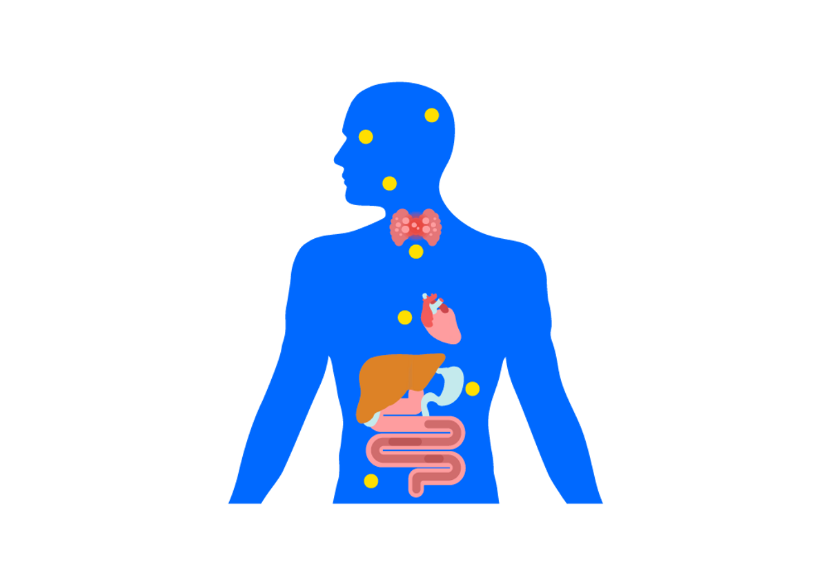Myxedema Coma | Symptoms, Causes, & Hypothyroidism | Buoy