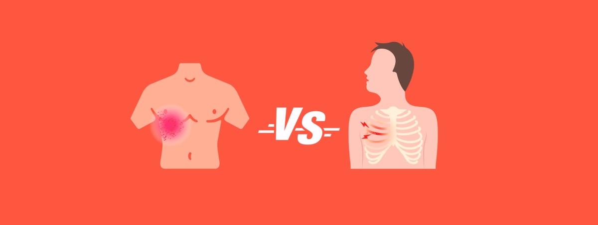 Bruised Ribs vs. Broken Ribs | Buoy