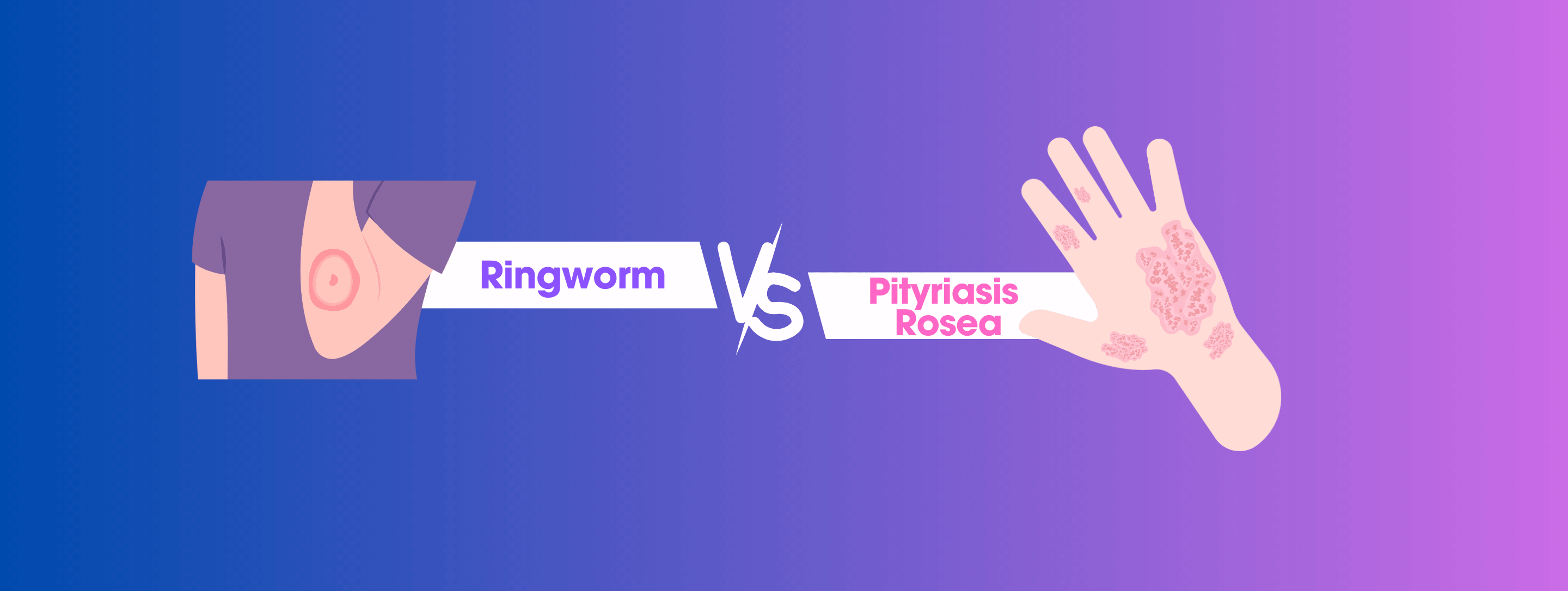 Ringworm Pictures How To Identify Ringworm On Your Body