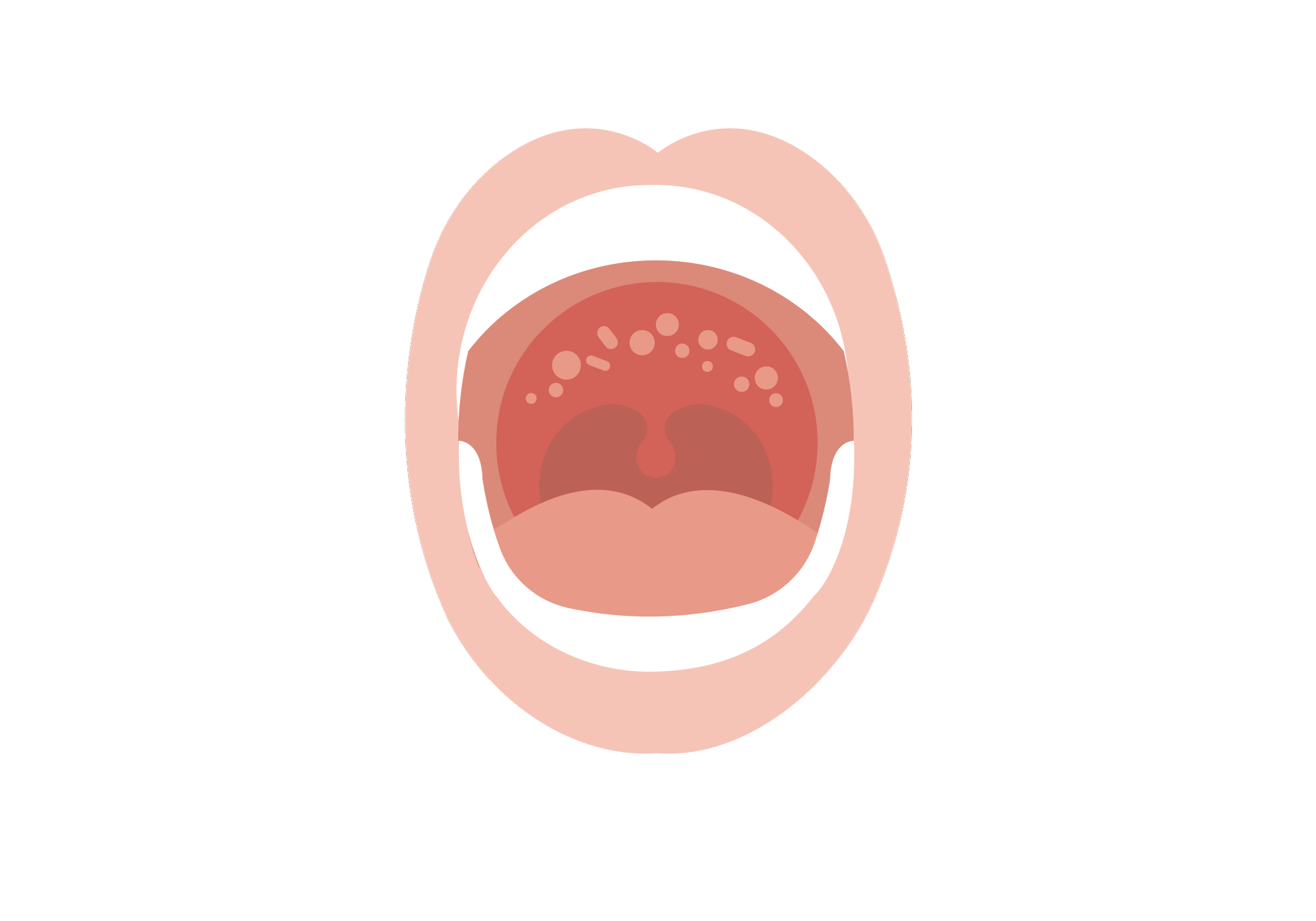 Pain and Sore Roof of Mouth | 4 Causes & Treatments