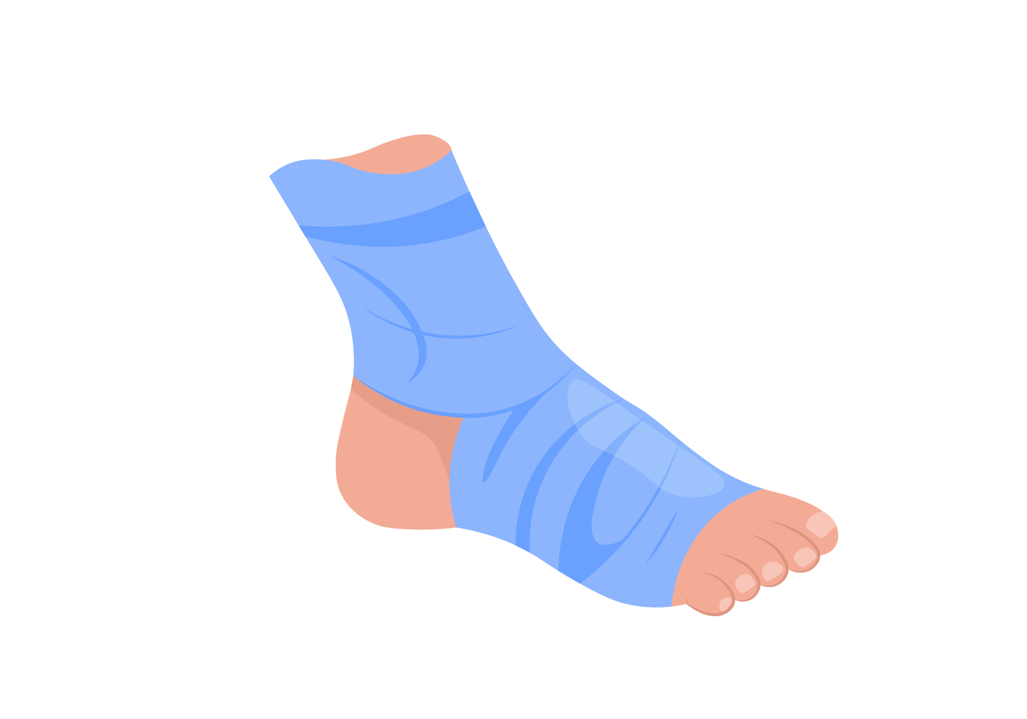 Foot Sprain | Diagnosis, Treatment by Grade & Recovery | Buoy