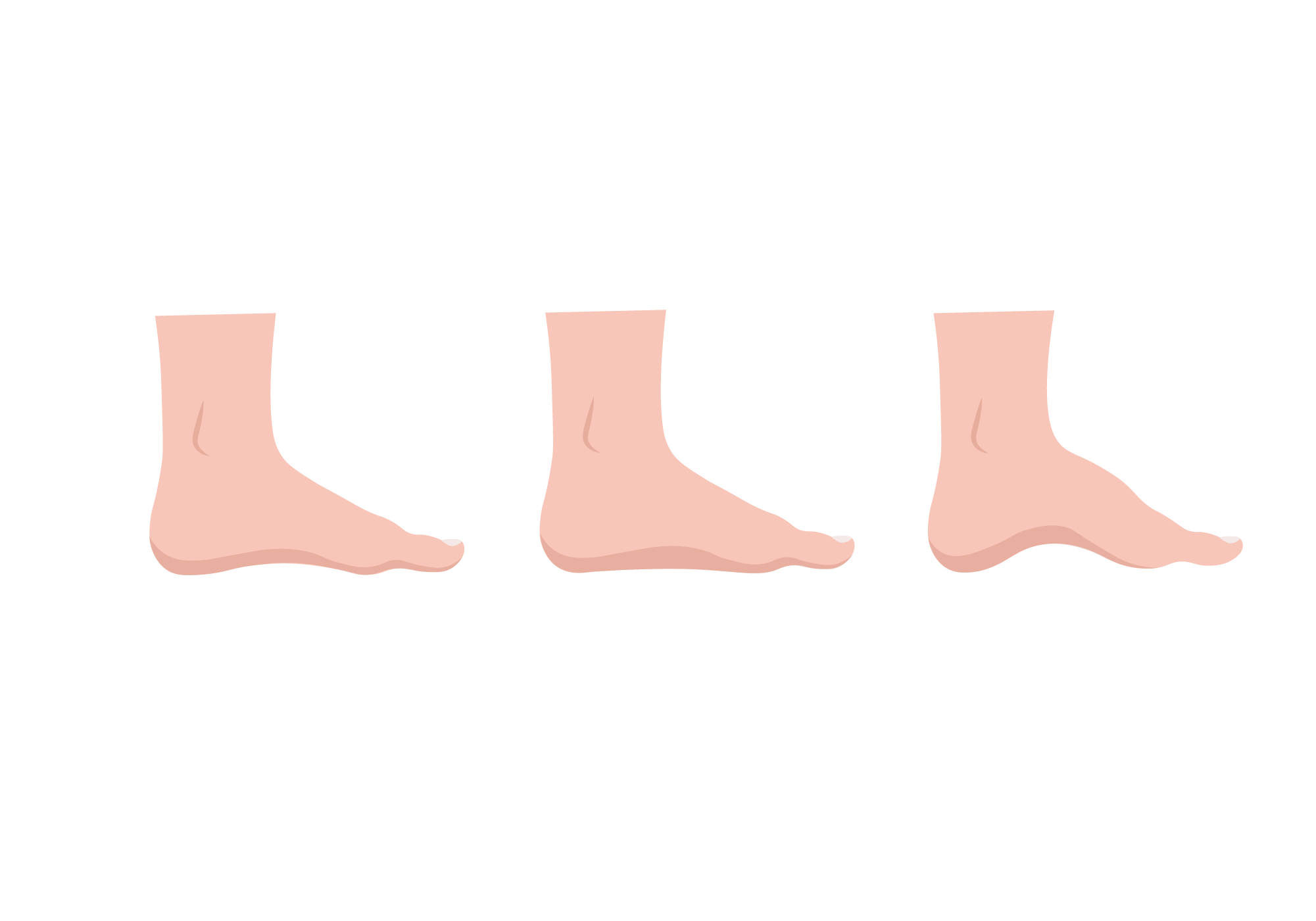 Foot Deformity Symptoms, Causes & Common Questions | Buoy