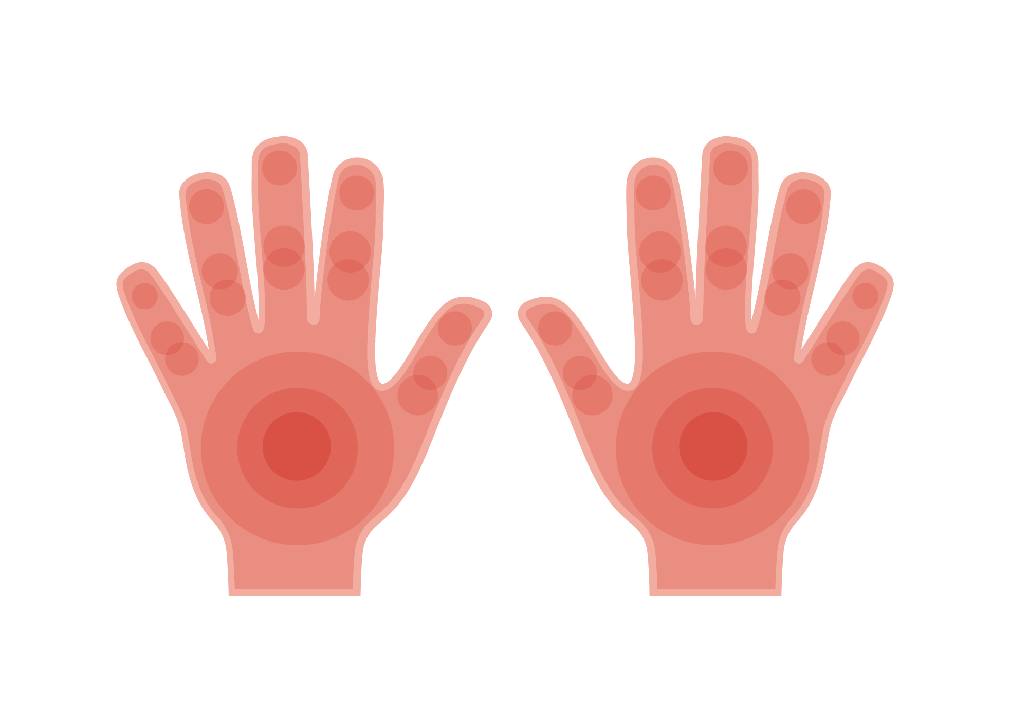 Rouge Palms Symptômes, Causes & Questions Communes | Buoy