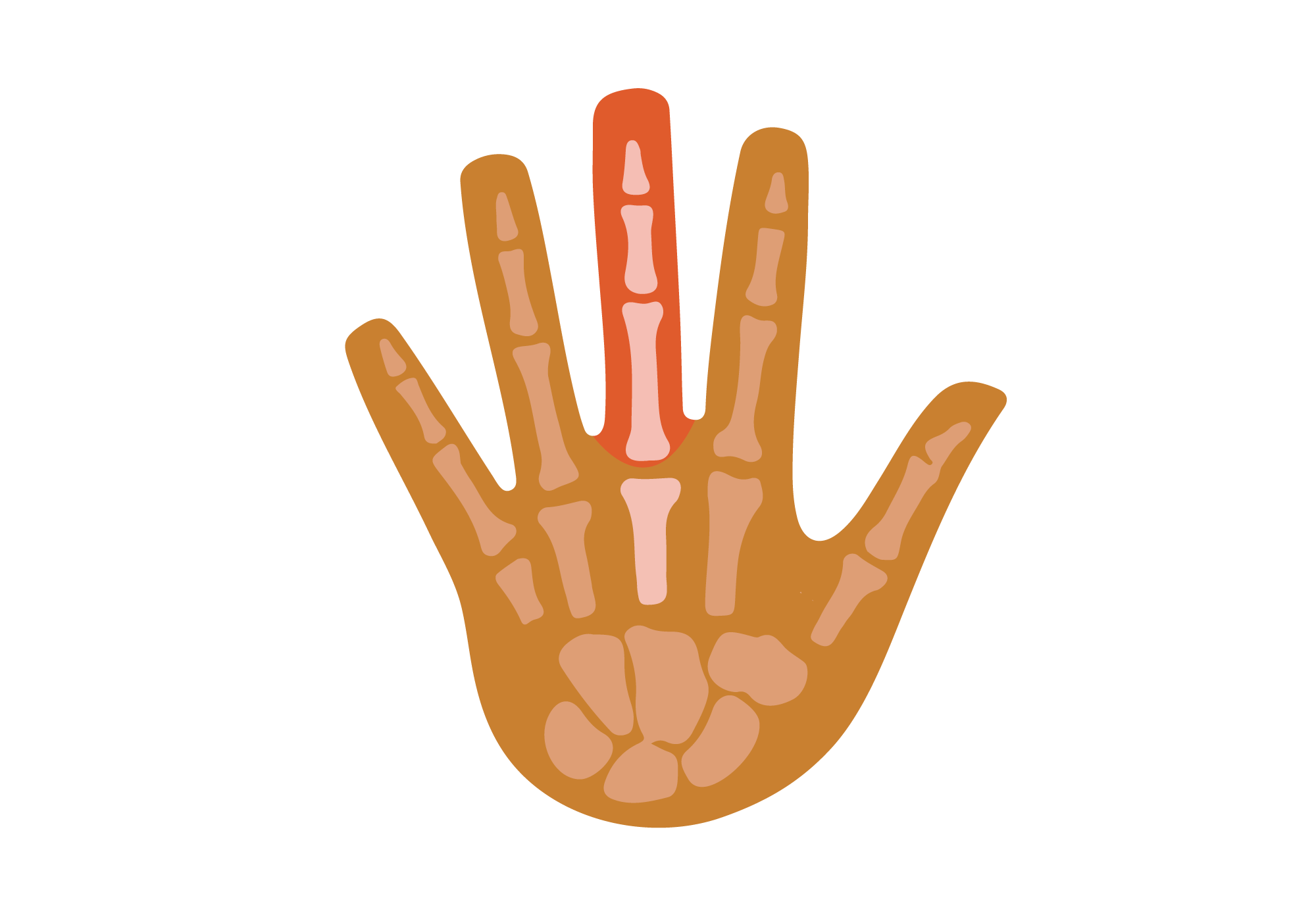 Middle Knuckle Pain: Causes & Treatment Options | Buoy