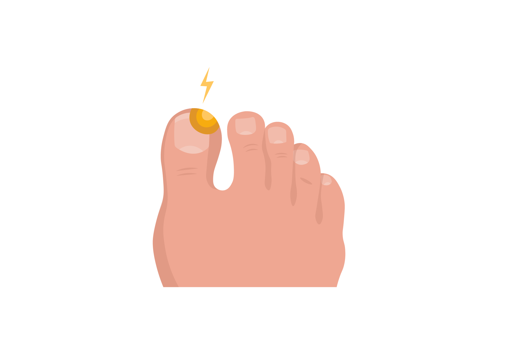 Toenail Pain | Causes & Treatments | Buoy Health