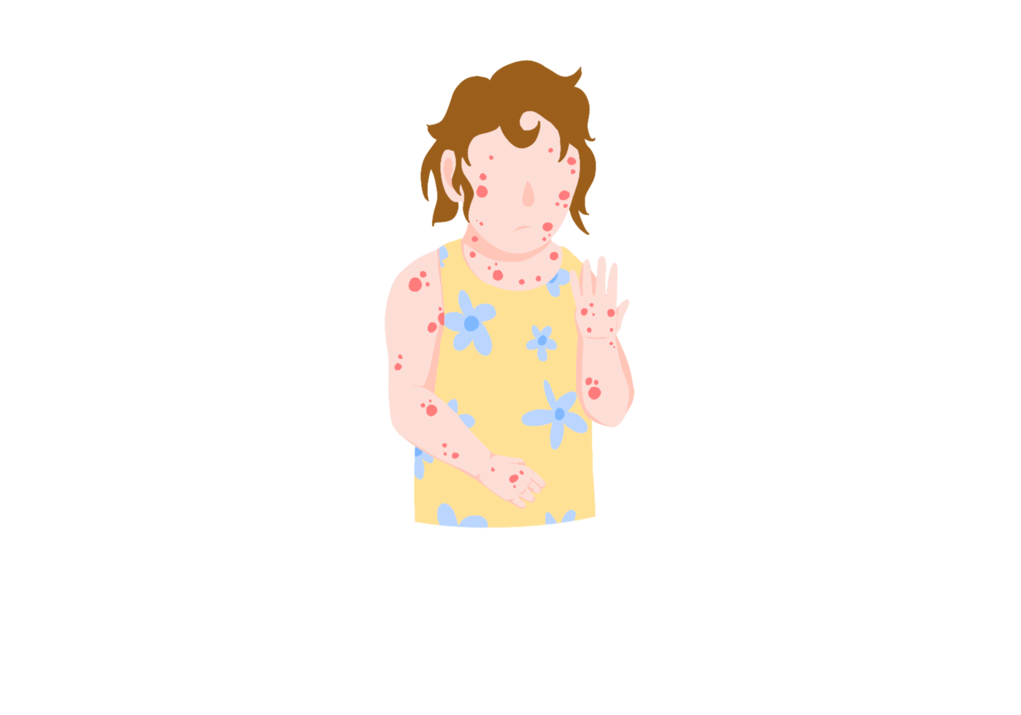 Varicelle | Varicella | Symptômes, Causes, & Traitement | Buoy