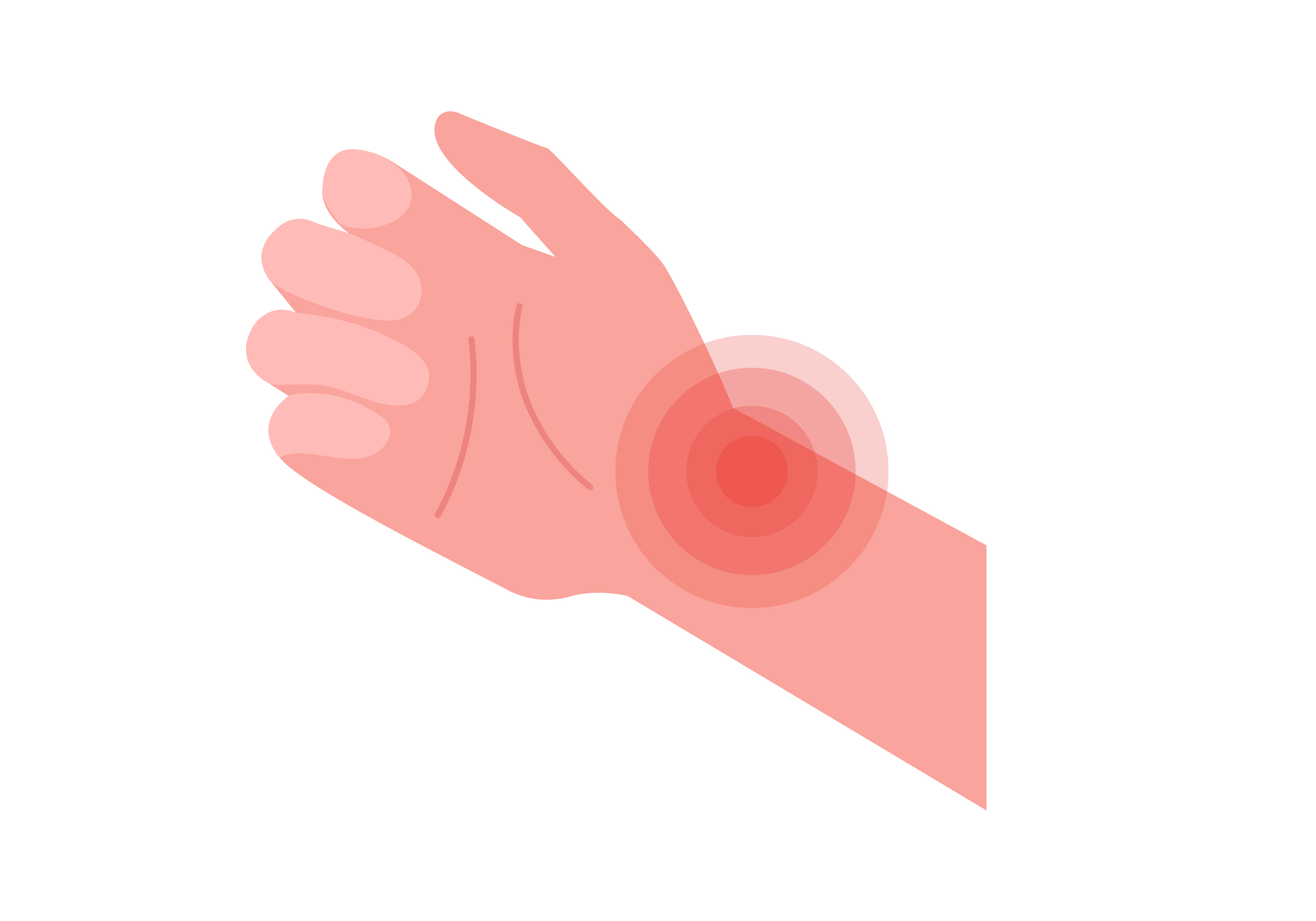 Wrist Sprain | 6 Signs of Sprain, Best Care, & Recovery | Buoy