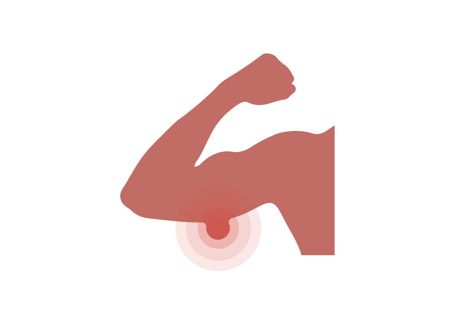 Bumps on Upper Arms Causes | Bicep and Tricep Lumps | Buoy