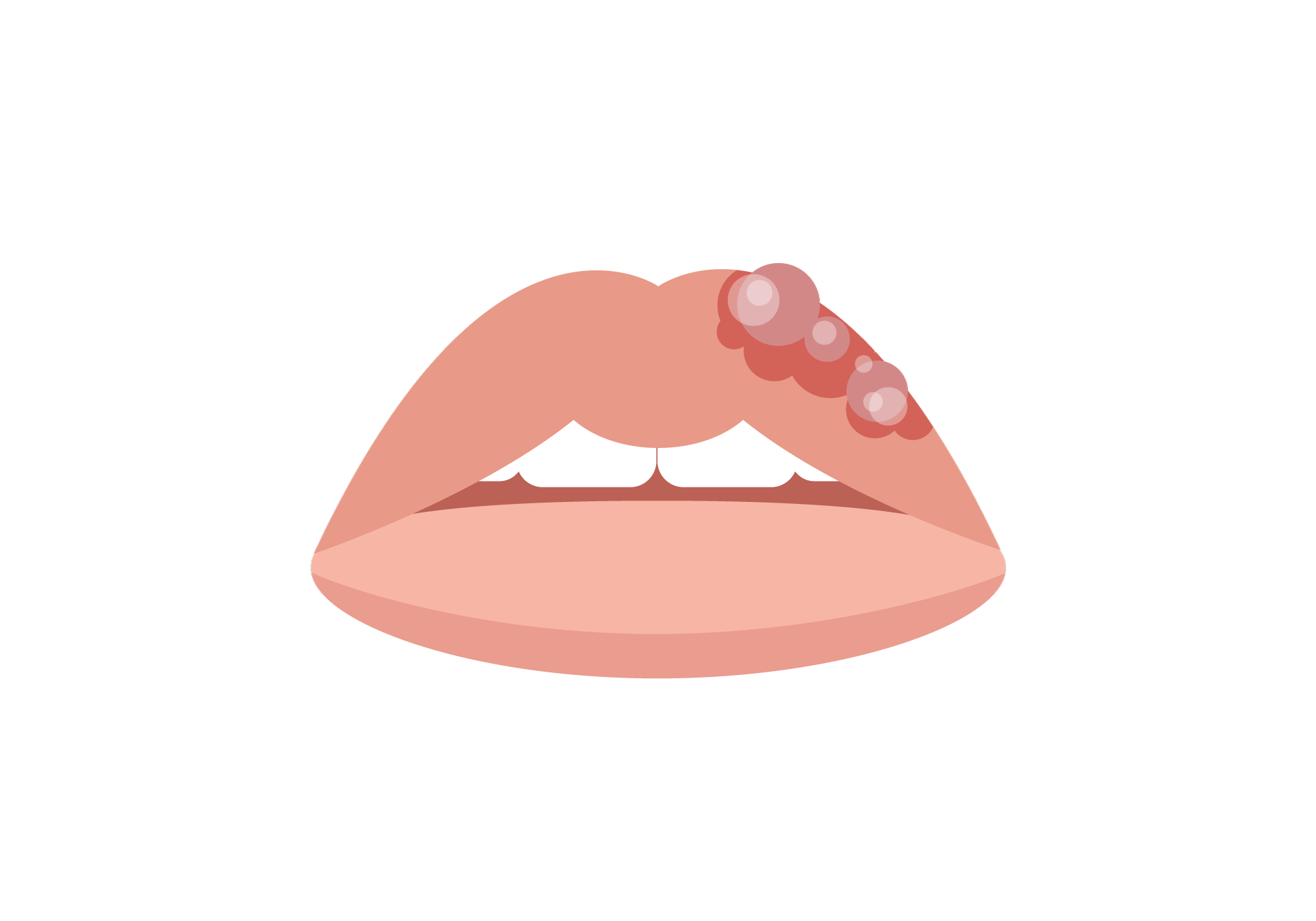 4 Common Triggers of Cold Sores & Fast Treatment