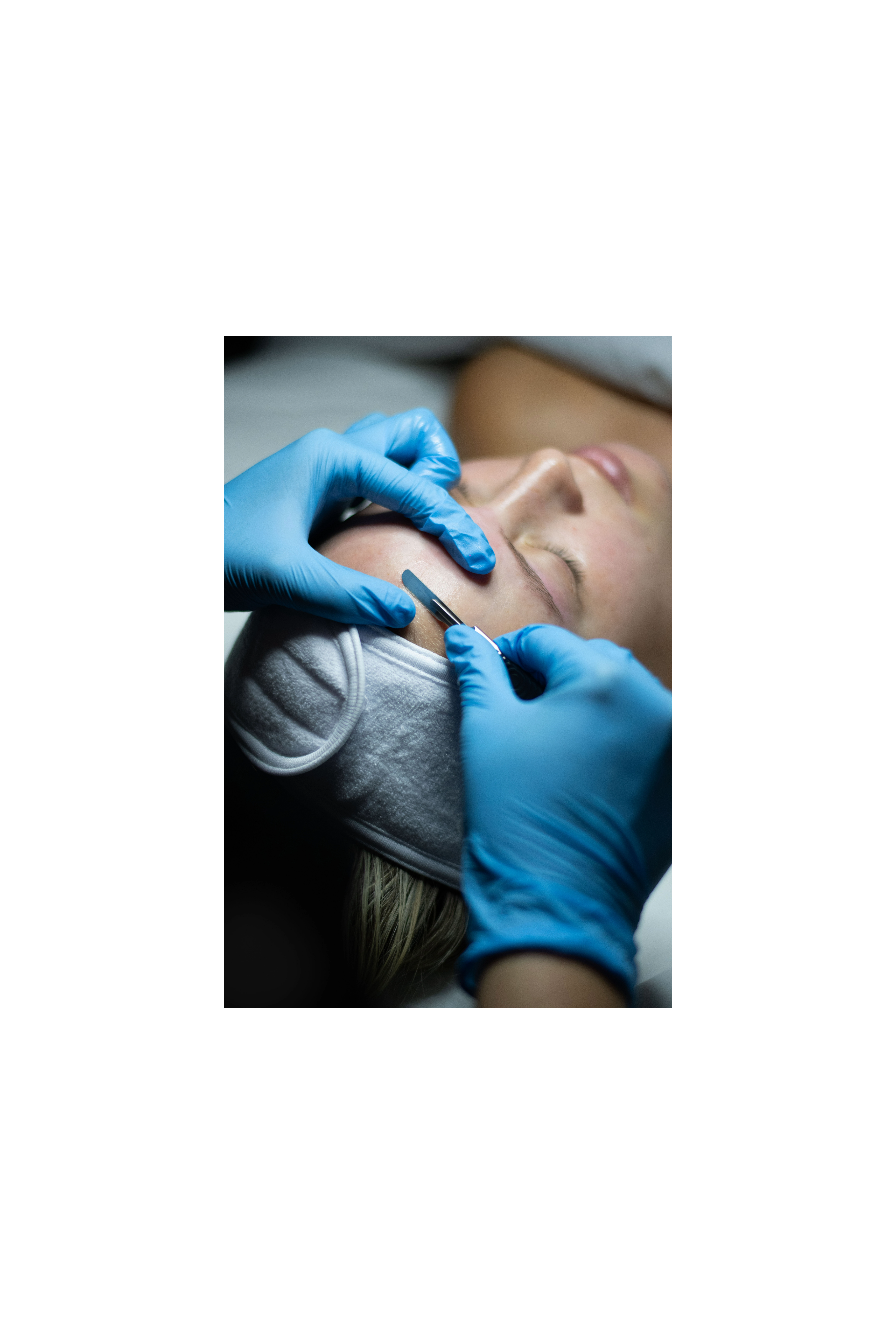 Dermaplaning Facial Sherman Oaks | Blue Medi Spa | Blue Medi Spa