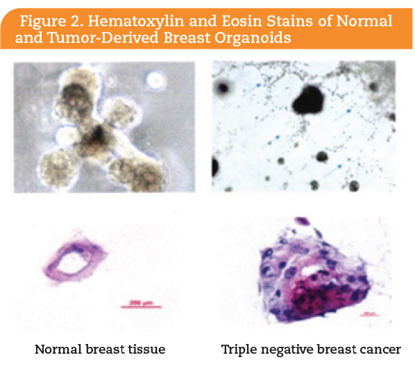 Patient-Derived Organoids Streamline Development and Testing of Drugs ...