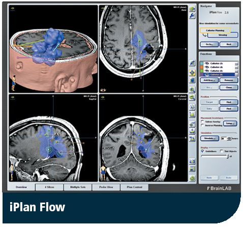 eShowcase: iPlan Flow