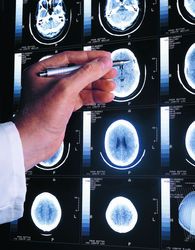 Real-World Evidence Studies