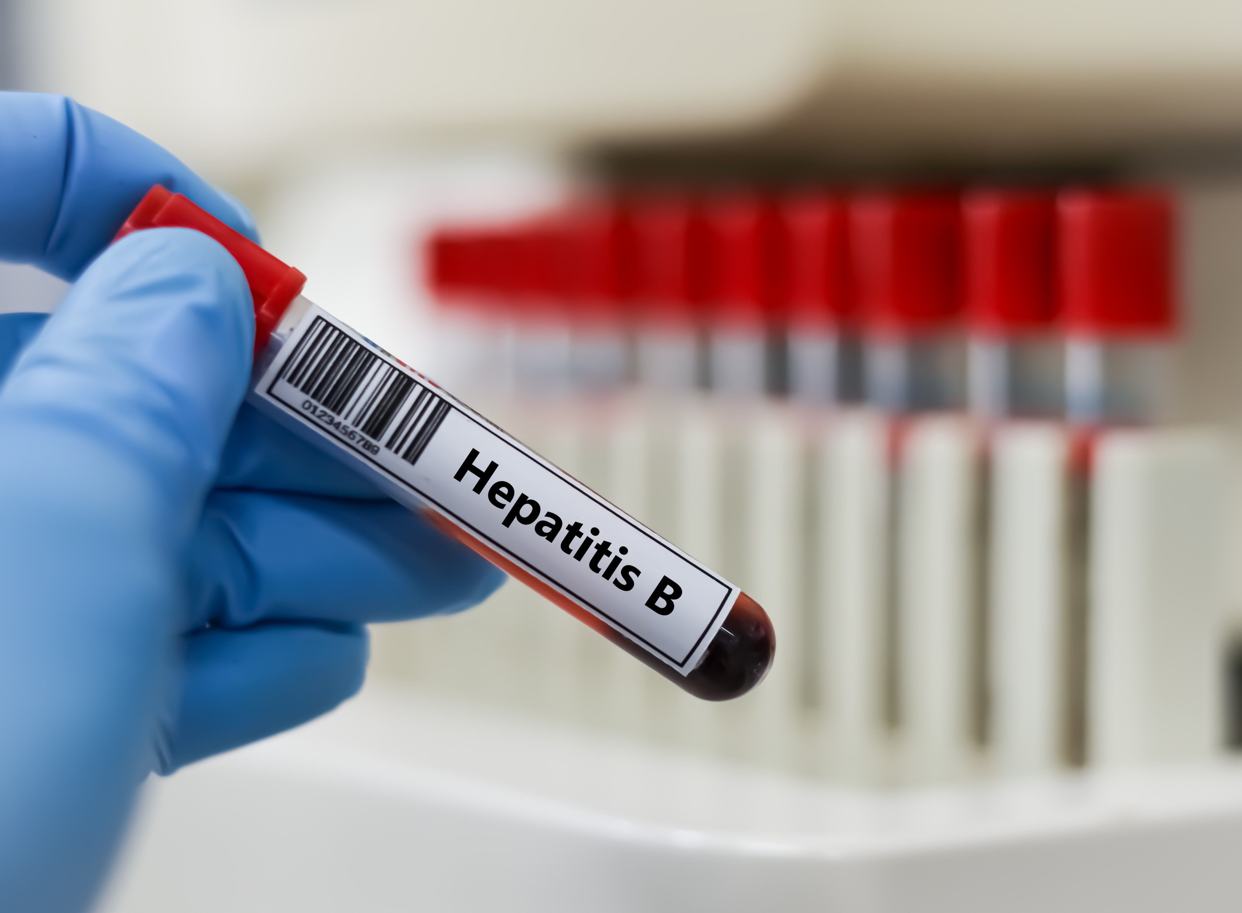 Bepirovirsen Achieves Clinically Meaningful Functional Cure Rates in ...