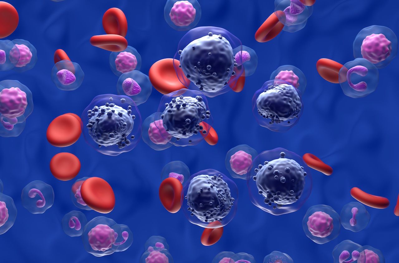 Research Into Reactive Oxygen Species Could Help Address AML Treatment ... Research Into Reactive Oxygen Species Could Help Address AML Treatment ...