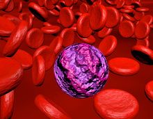 ATO Plus ATRA Shows EFS Benefit in Newly Diagnosed, High-risk APL ...