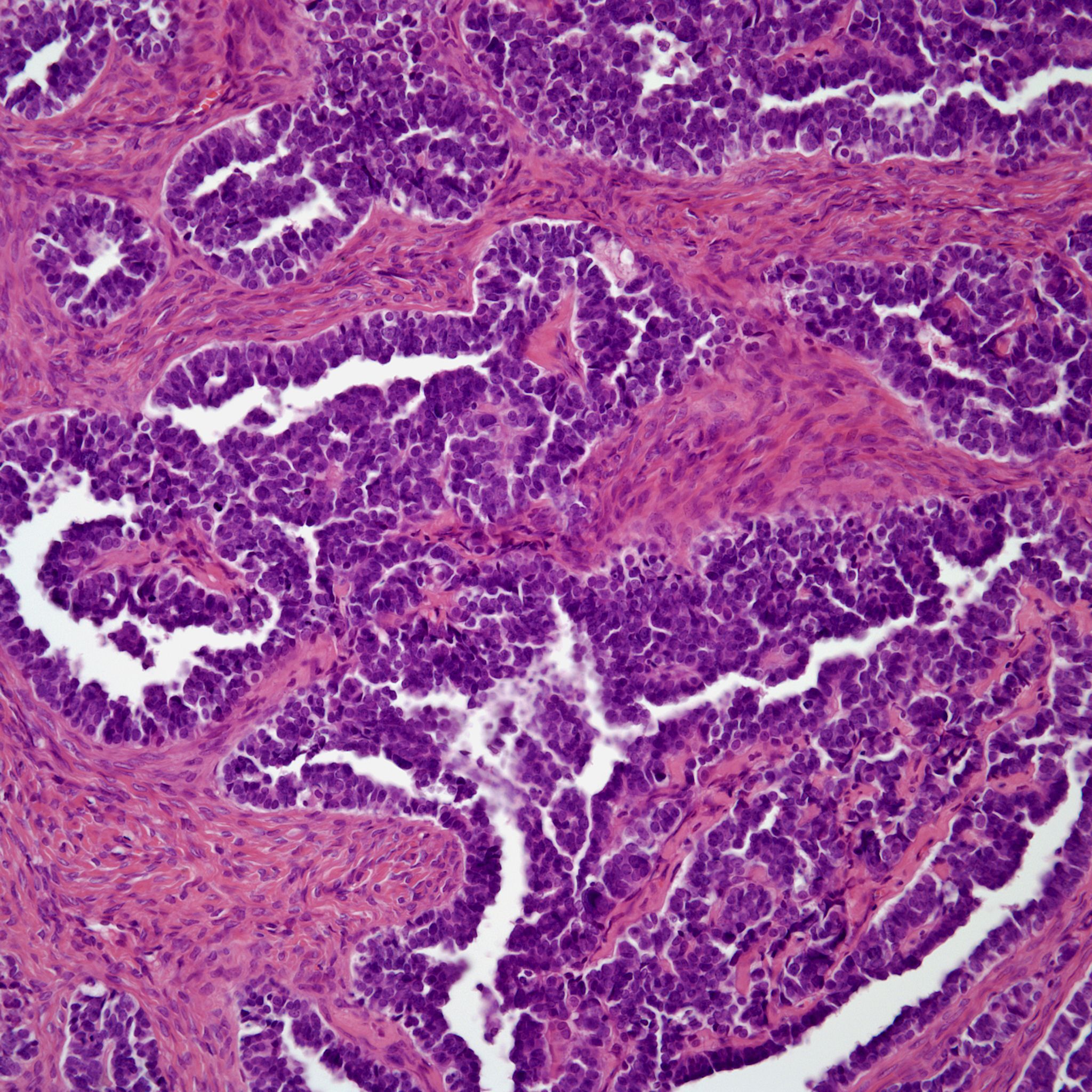 Diagnose The Pelvic Mass In A 22 Year Old