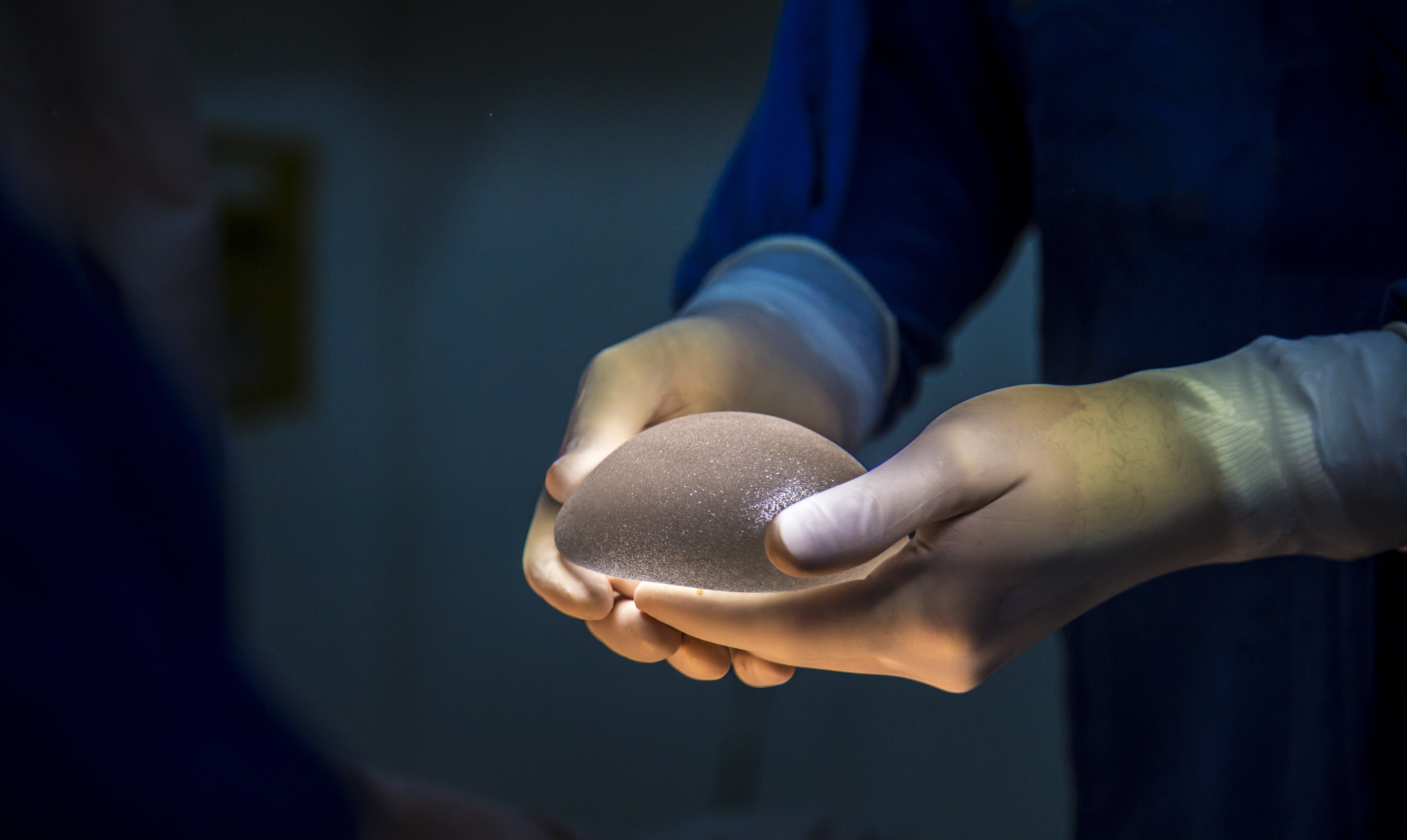 Guidelines for BIA-ALCL Provide Additional Guidance for Recognition and ...