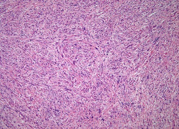 Treatment Combination May Be Effective for Antitumor Activity in ...