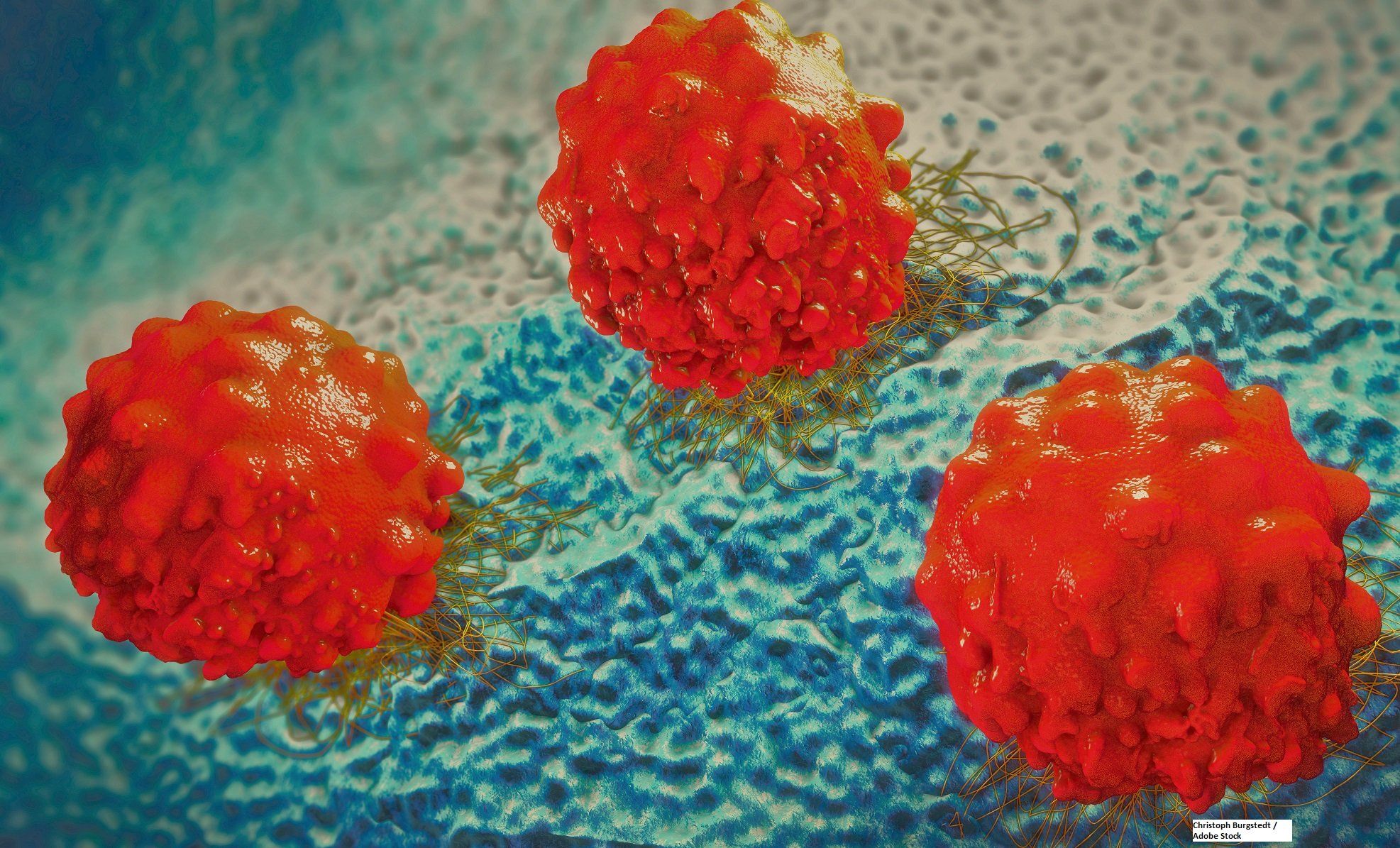 Umbralisib Offers Promise for Marginal Zone Lymphoma