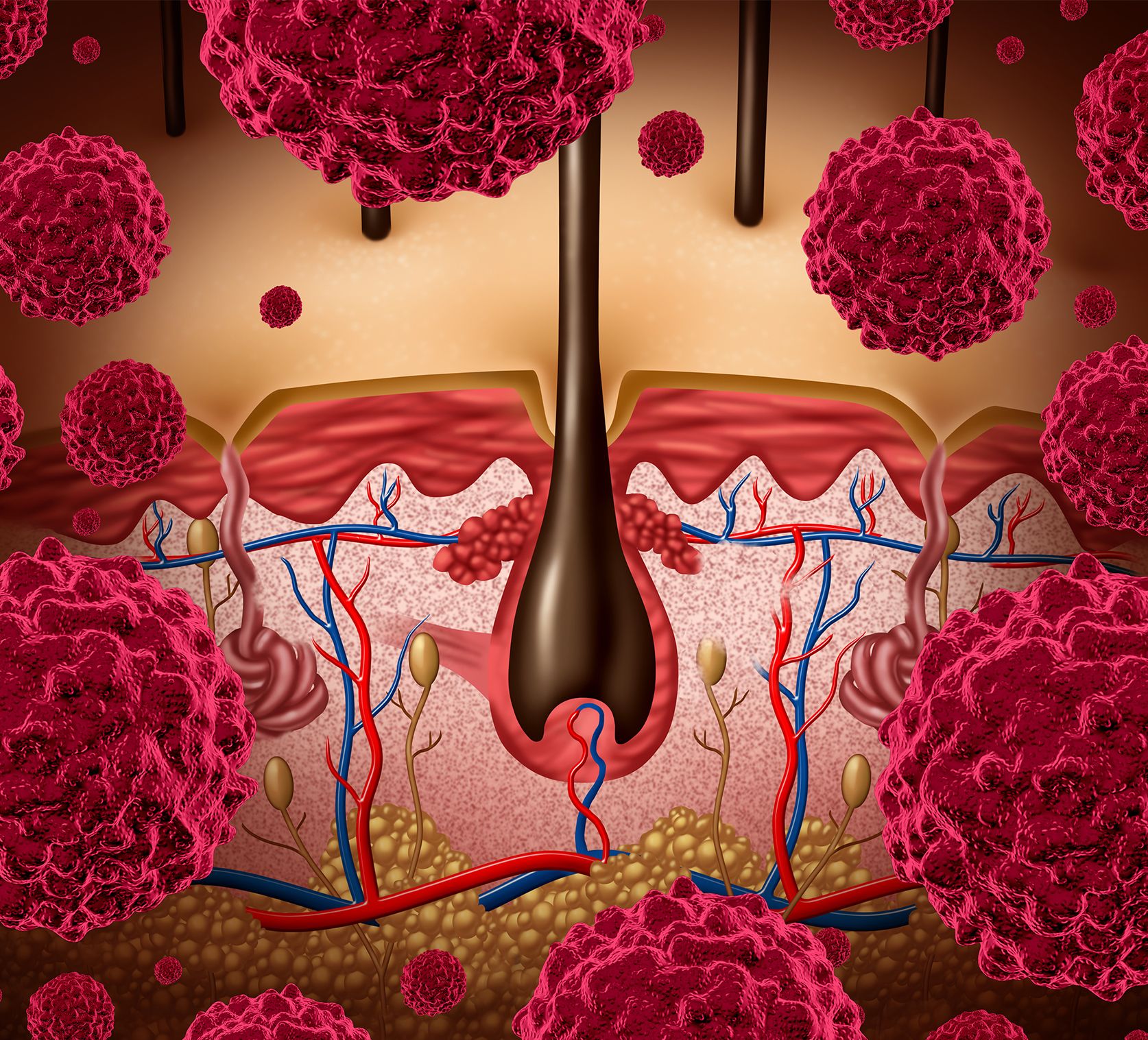 FDA Gives RP1 Combo Complete Response Letter in Advanced Melanoma