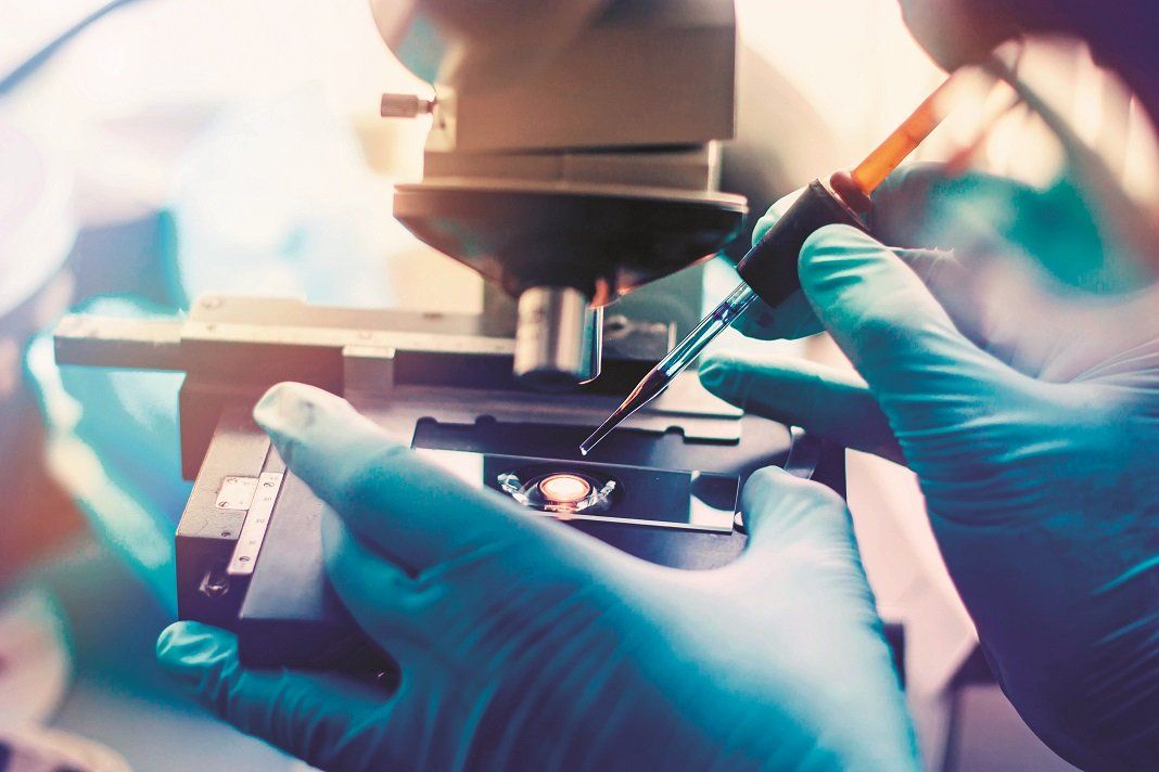 Identifying Molecular Markers of Relapse in Myelodysplastic Syndrome