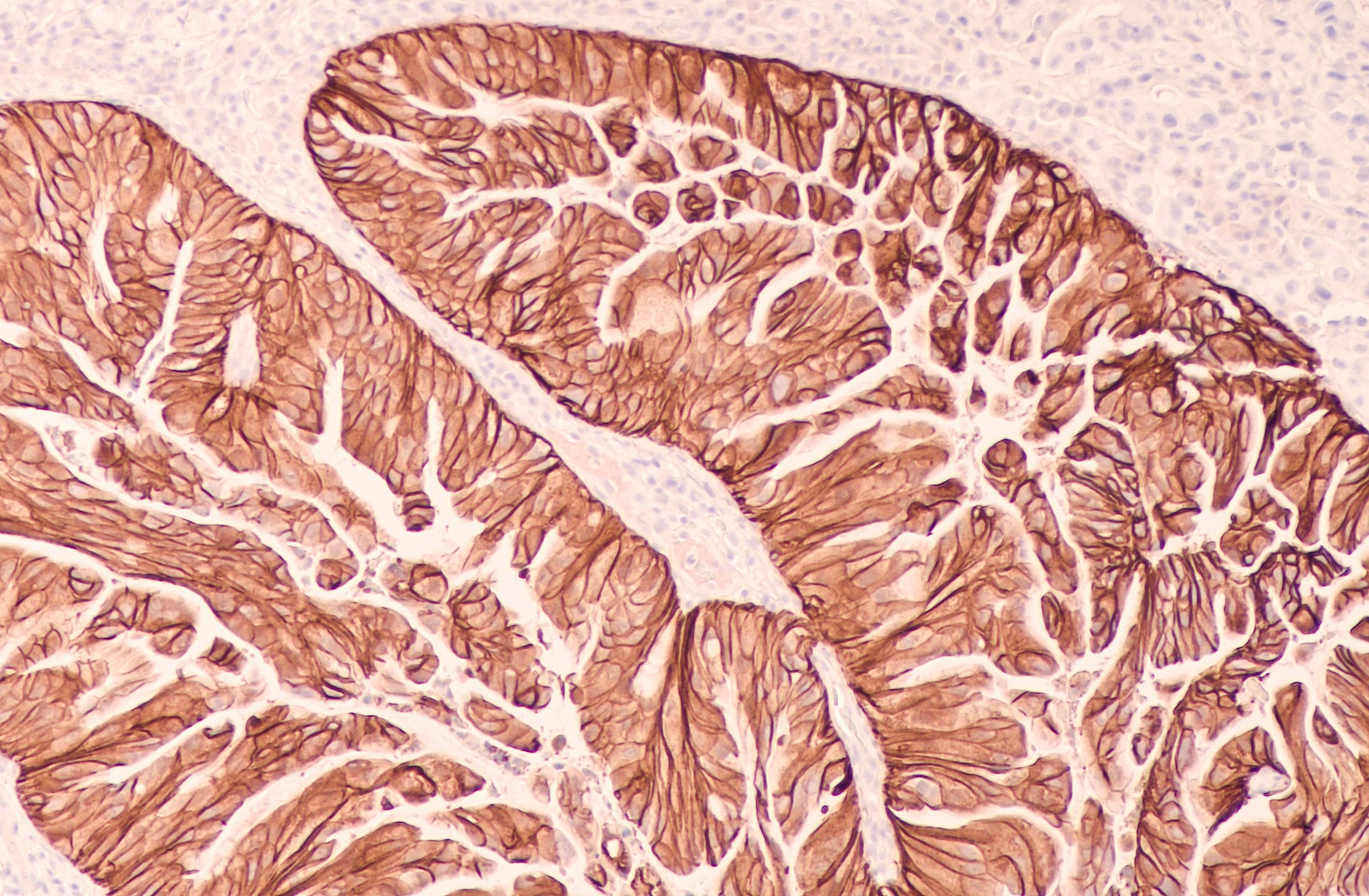 Updated Data And Groundbreaking Research Lead To An Exciting 2023 ASCO GI updated-data-and-groundbreaking-research-lead-to-an-exciting-2023-asco-gi