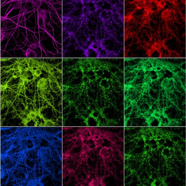 Imaging Tool Offers Insights into Human Brain
