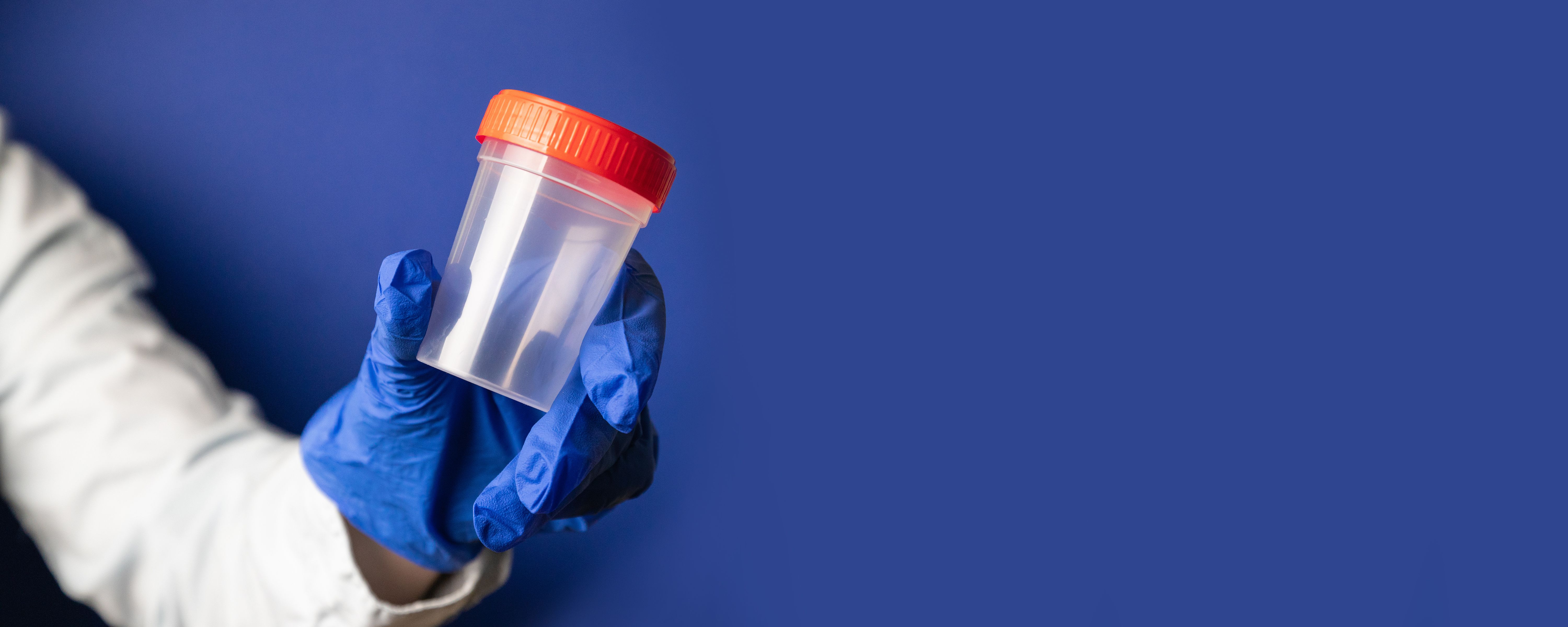 Putting the Sample into Sample Preparation | LCGC International