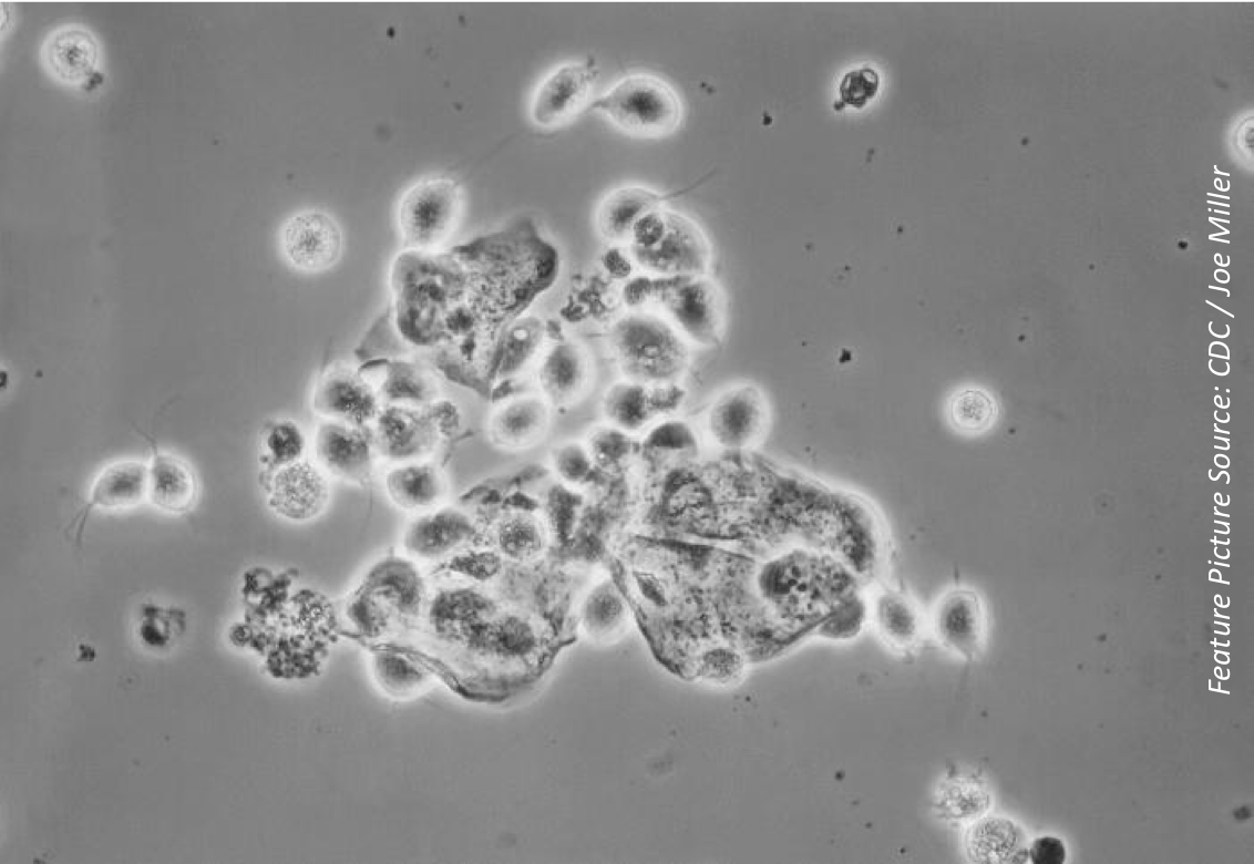 Most Common Curable STI Disproportionately Affects Black Community