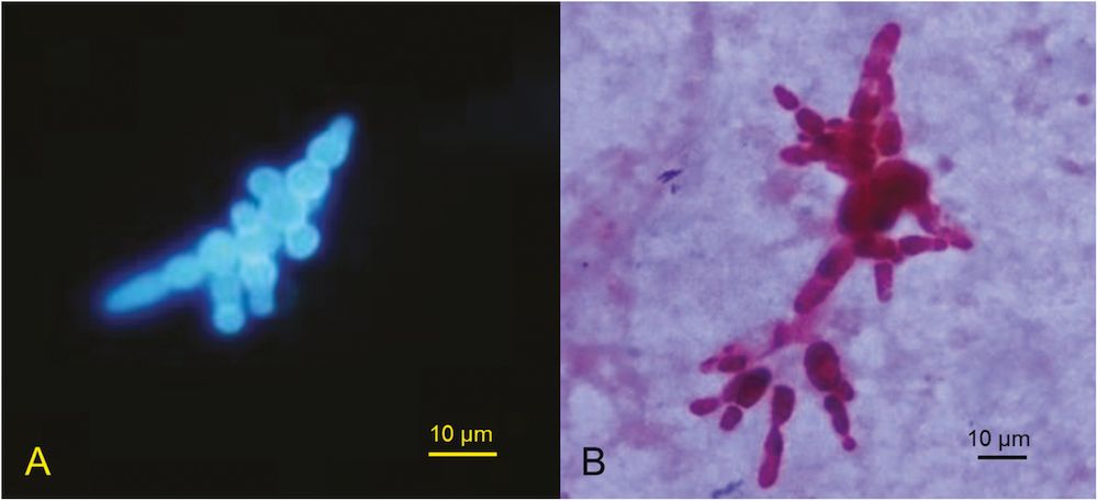 Dimorphic Fungal Pathogen May Be Causing Fatal Infections in Western US ...