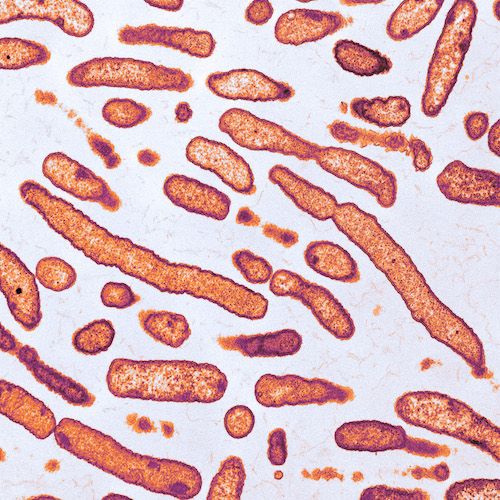 Rare Bacteria Make Their Way to New York State