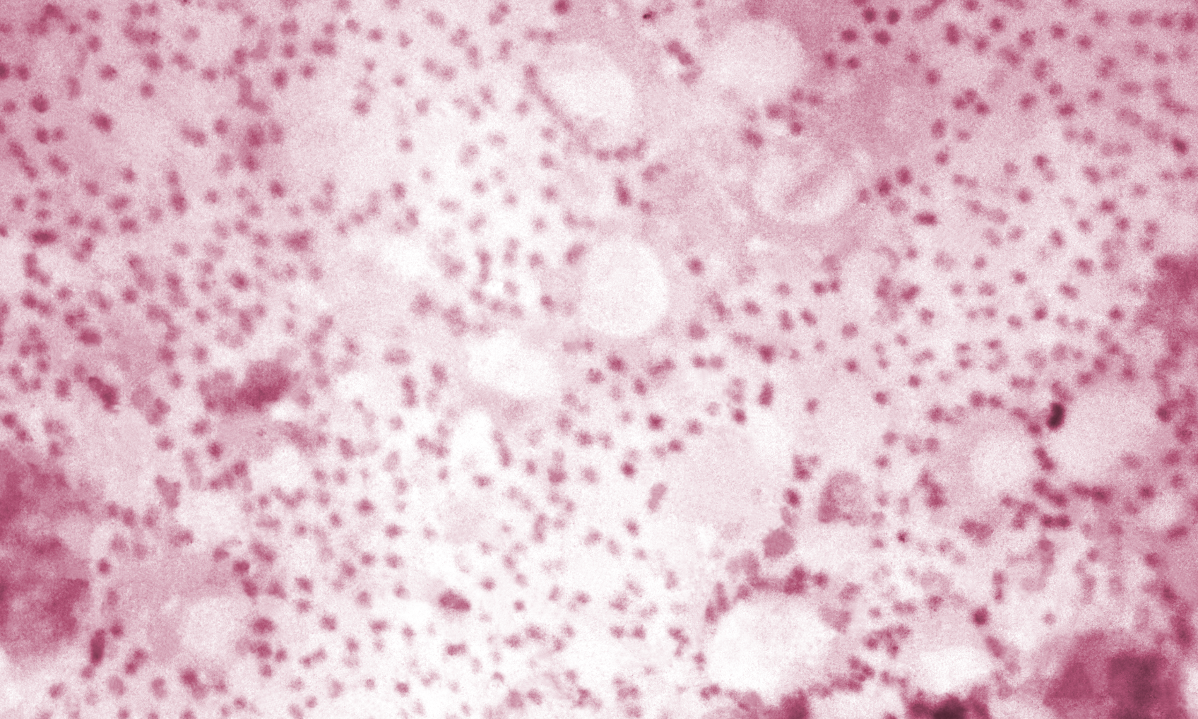 Is Yersinia Pestis Gram Positive Or Negative