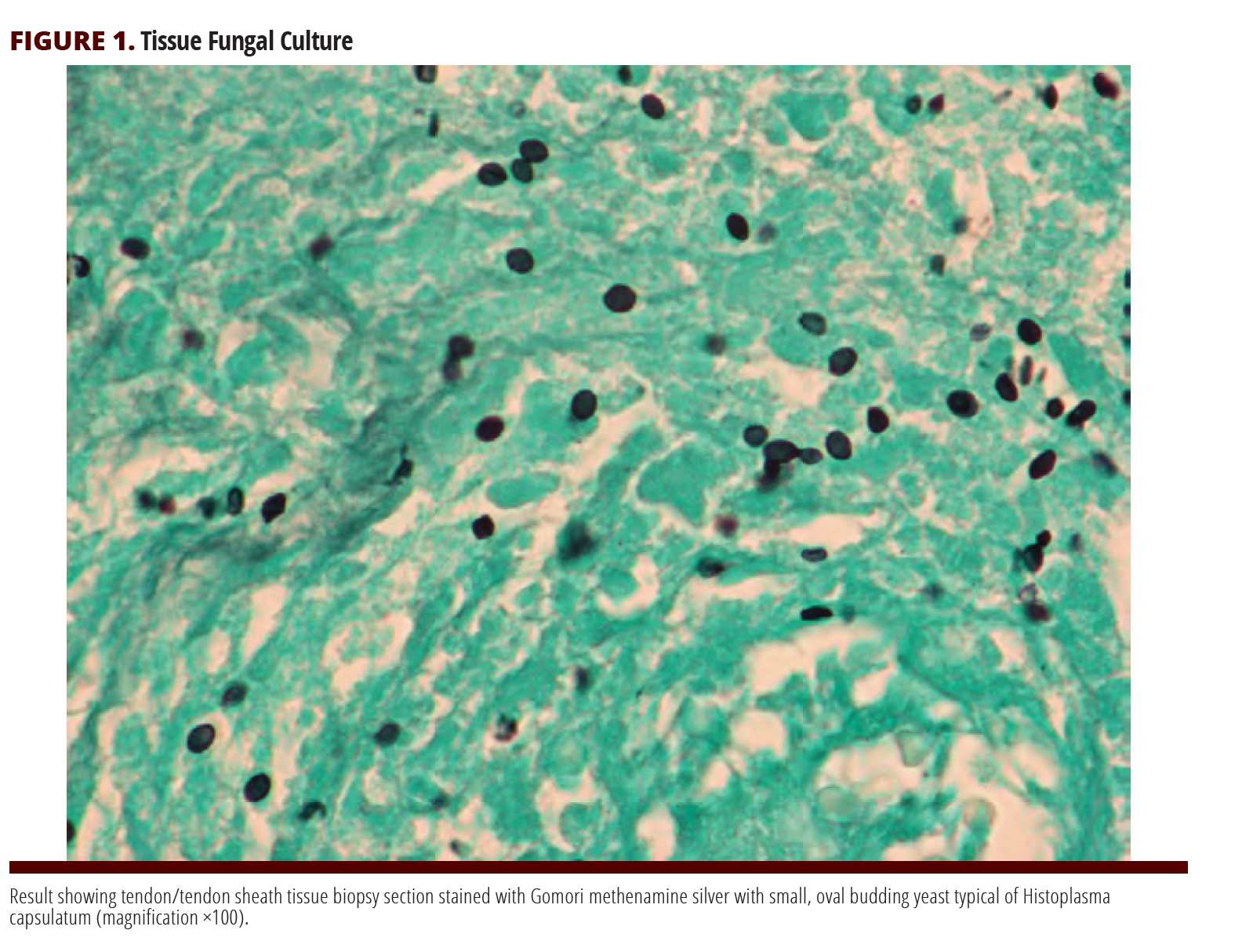 john grocott barrett