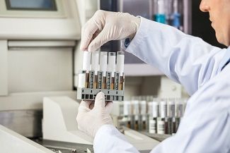 USPSTF Updates Recommendations for Asymptomatic Bacteriuria Screening