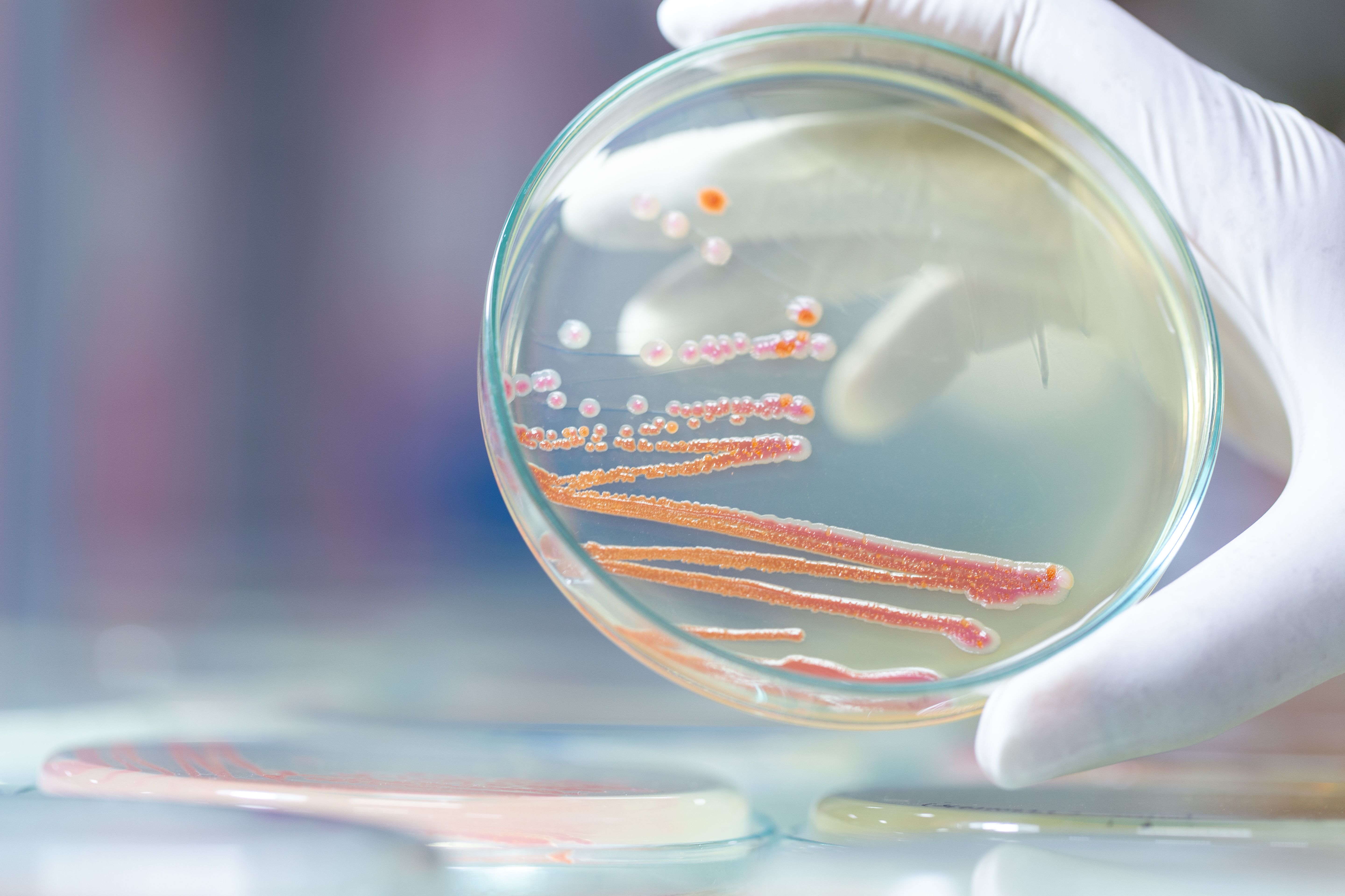 CREating New Strategies for the Treatment of Resistant Gram-Negative ...