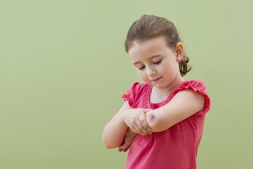 Daptomycin Effective Against MRSA Skin Infections in Children