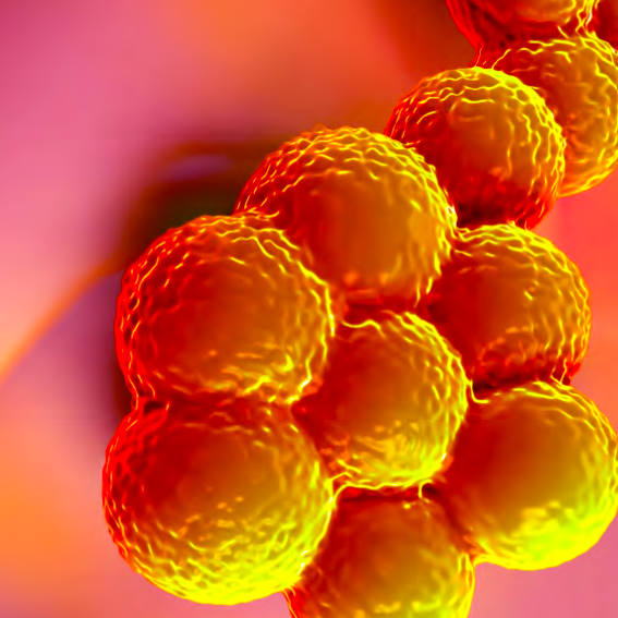 Daptomycin as Frontline Therapy for MRSA Bacteremia: Has the Time Come?