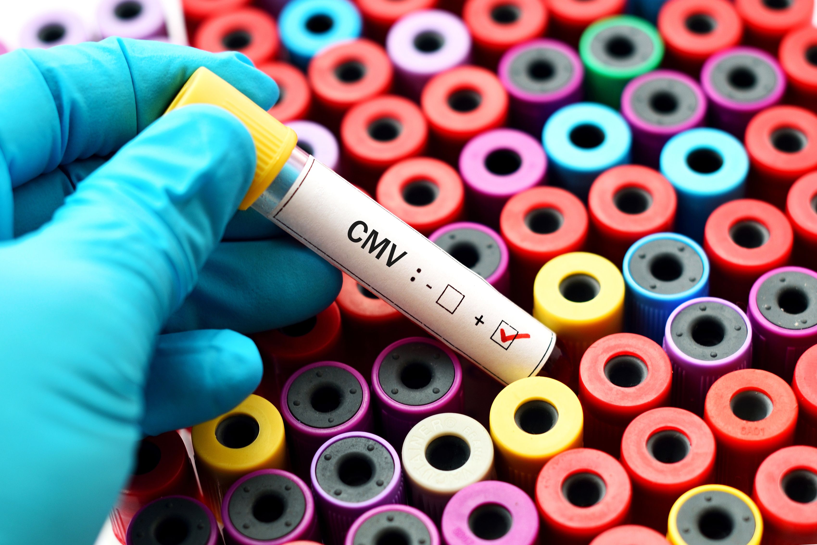 Cytomegalovirus: What every physician needs to know | Contemporary OB/GYN