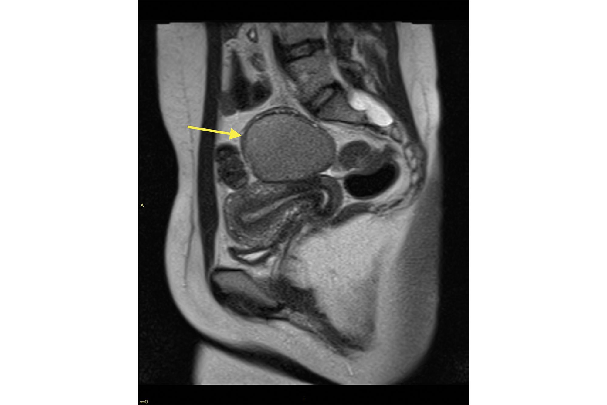 The value of GBCA in MRI images | Contemporary OBGyn
