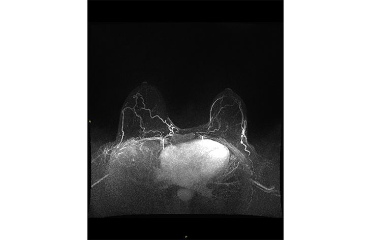 8 examples of how GBCA improves MRI
