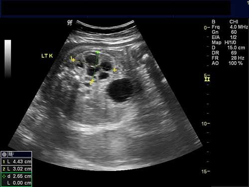 Image IQ: Third Trimester Kidneys